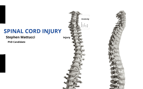 Spinal Cord Injury by Stephen Mattucci on Prezi