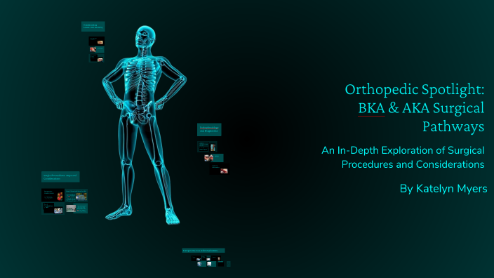 Orthopedic Spotlight: BKA & AKA Surgical Pathways by katelyn myers on Prezi