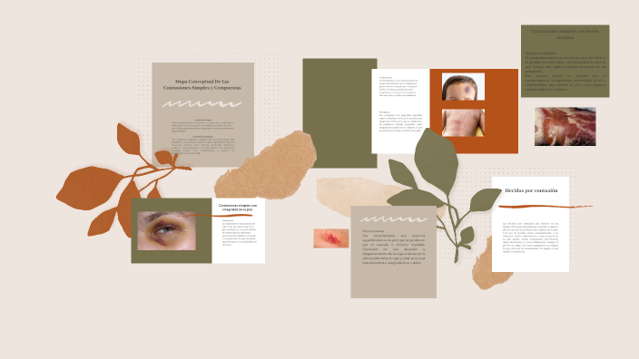 Mapa Conceptual De Las Contusiones Simples y Compuestas by Mtz Aguilar ...