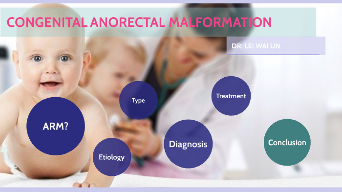CONGENITAL ANORECTAL MALFORMATION by un lee on Prezi