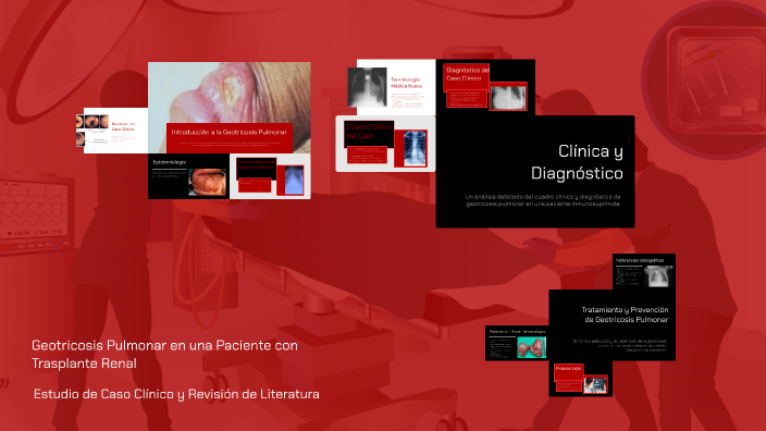 Geotricosis Pulmonar en una Paciente con Trasplante Renal by 11-MH-HU ...