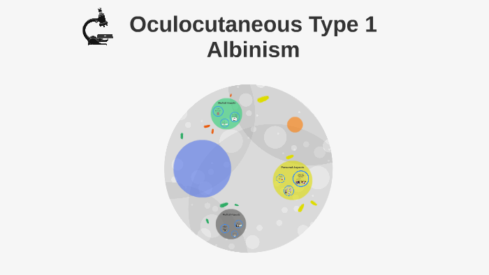 Oculocutaneous Type 1 Albinism by Lauren P on Prezi
