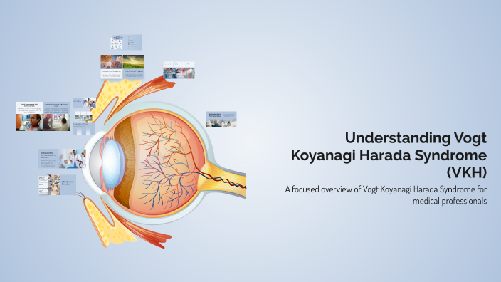 Understanding Vogt Koyanagi Harada Syndrome (VKH) by Sunidhi Kumari on ...