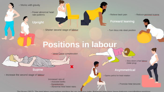 Positions in labour by jorja kirkwood on Prezi