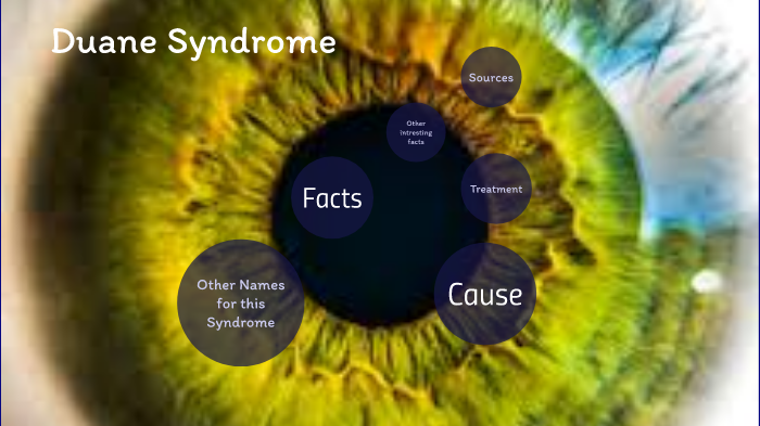 Duane Syndrome by Toby Corriston on Prezi