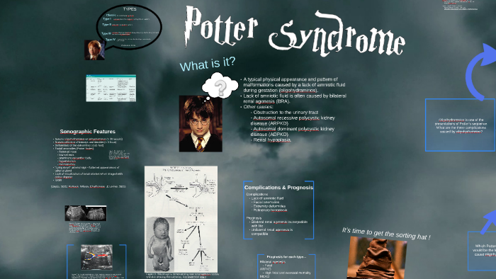 Potter's Syndrome by serena harper on Prezi