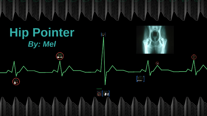 Hip Pointer by Mel