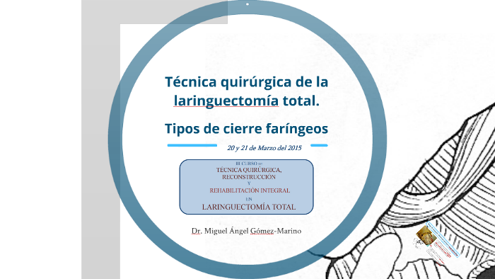 Laringectomía total by M GM on Prezi