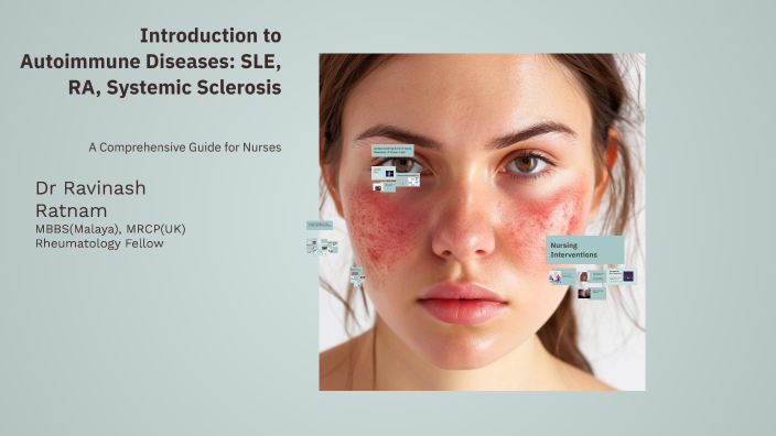 Introduction to Autoimmune Diseases: SLE, RA, Systemic Sclerosis, and ...