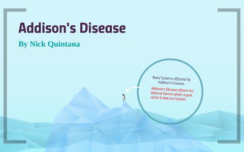 Addison's Disease by Nick Quintana on Prezi