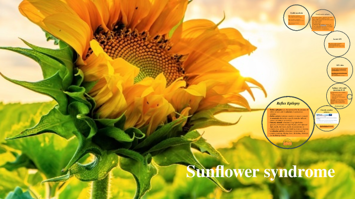 Reflex epilepsy by Areej Elkamil on Prezi