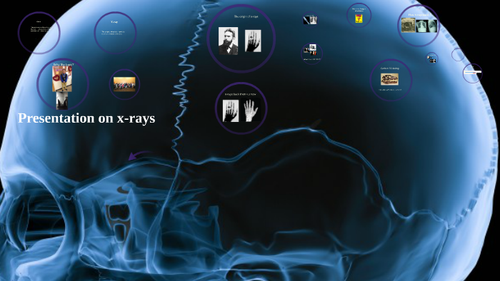 X-ray by Jerry Naranjo on Prezi