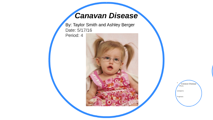 Canavan Disease by Taylor Smith on Prezi