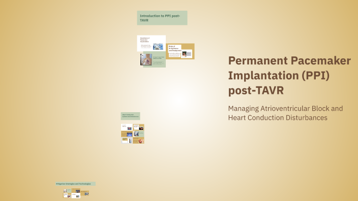 Permanent Pacemaker Implantation (PPI) post-TAVR by sujeet on Prezi