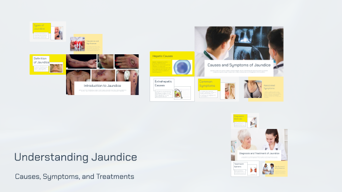 Understanding Jaundice by Haydi John on Prezi