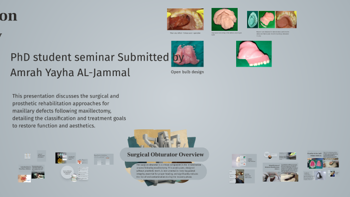 Prosthetic Rehabilitation of Maxillary Defects by Amra Algamal on Prezi