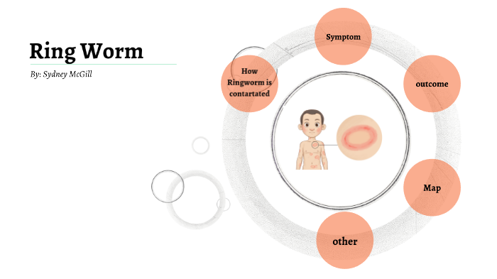 RingWorm by sydney mcgill on Prezi