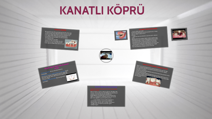 KANATLI KÖPRÜ by Rukiye Nur Taş on Prezi