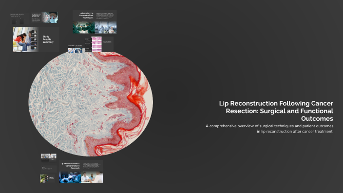 Lip Reconstruction Following Cancer Resection: Surgical and Functional ...
