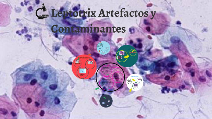 Leptotrix Contaminantes y Artefactos by Ines Salas on Prezi