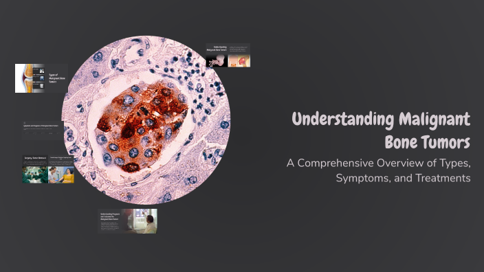 Understanding Malignant Bone Tumors by بشار الرعود on Prezi