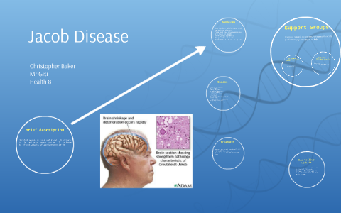 Jacob Disease by Christopher Baker on Prezi