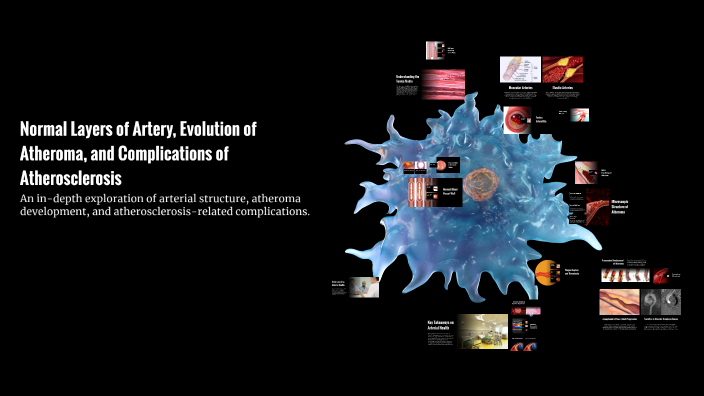 Normal Layers of Artery, Evolution of Atheroma, and Complications of ...