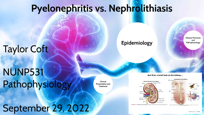 Pyelonephritis vs. Nephrolithiasis by Taylor Coft on Prezi
