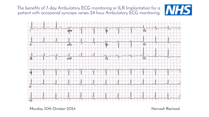 7-Day ECG & ILR vs 24-Hour ECG by Hamzah Khatoon Rasheed on Prezi