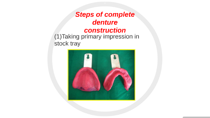 Steps of complete denture construction by hadeel elwi on Prezi