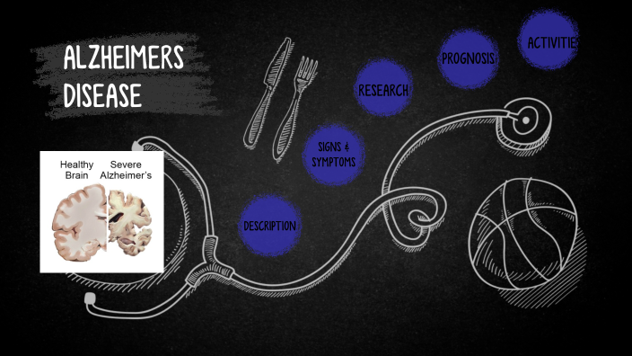 Alzheimers Disease by Alexis Minter on Prezi