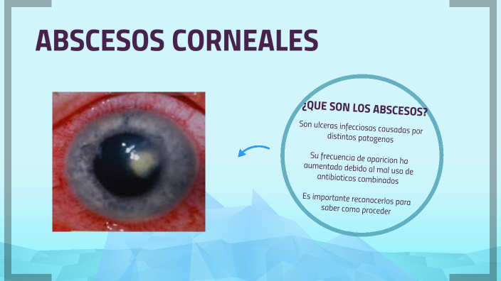 ABCESOS CORNEALES by celi castagnino on Prezi