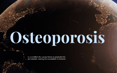 Osteoporosis by shondell simon on Prezi