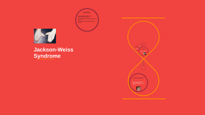 Jackson-Weiss Syndrome by Ethan Hartman on Prezi