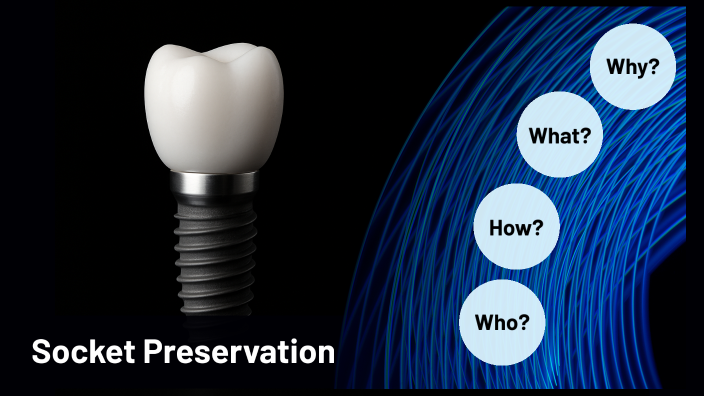 Socket Preservation by Guy Happy on Prezi