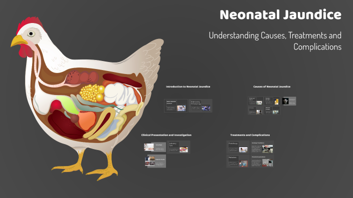 Neonatal jaundice by Mawaddah Alshampaty on Prezi