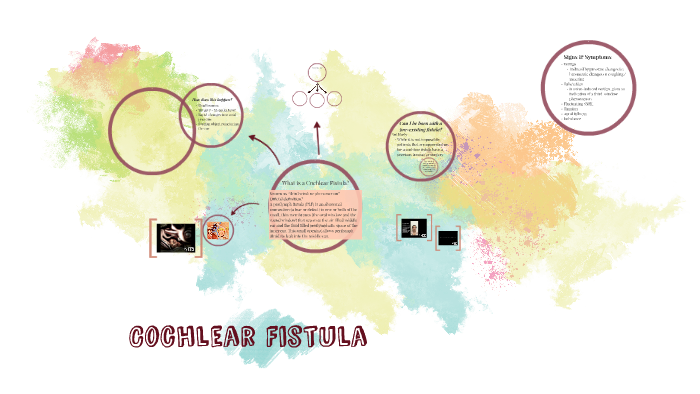 Cochlear Fistula by Alexis Hickox on Prezi