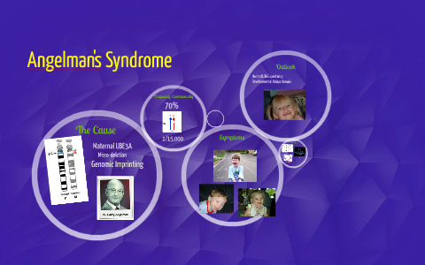 Angelman's Syndrome by Aidan W on Prezi
