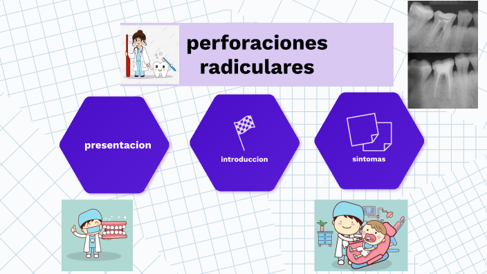 perforaciones radiculares by Lesly Almendra Alvarez on Prezi