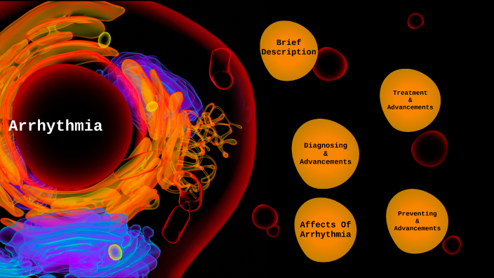 Arrhythmia Concept Map by Piranavie Gunarajan on Prezi