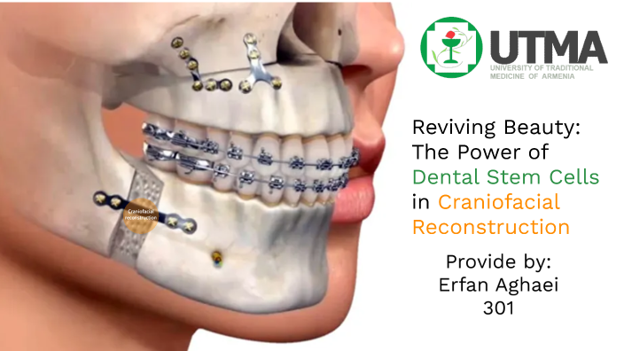 Dental stem cells and craniofacial reconstruction by sy k on Prezi