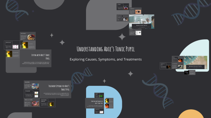 Understanding Adie’s Tonic Pupil by Ala Abukhalil on Prezi