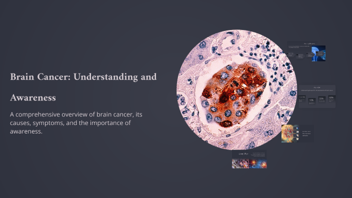 Brain Cancer: Understanding and Awareness by Shayan Safari on Prezi