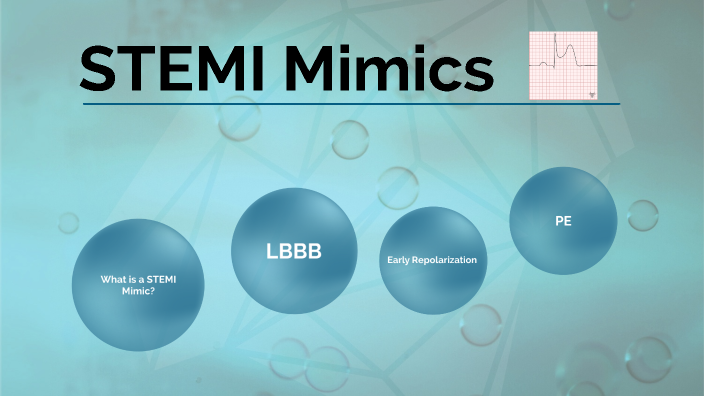 STEMI Mimics by Samantha Hiller on Prezi