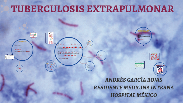 TB extrapulmonar by Andrés García on Prezi