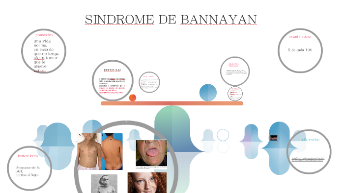 síndrome de BANNAYAN by lupita perez on Prezi