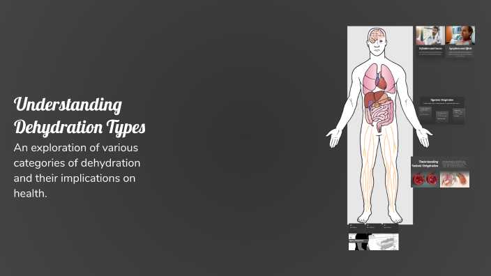 Understanding Dehydration Types by Maha Ibrahiem on Prezi