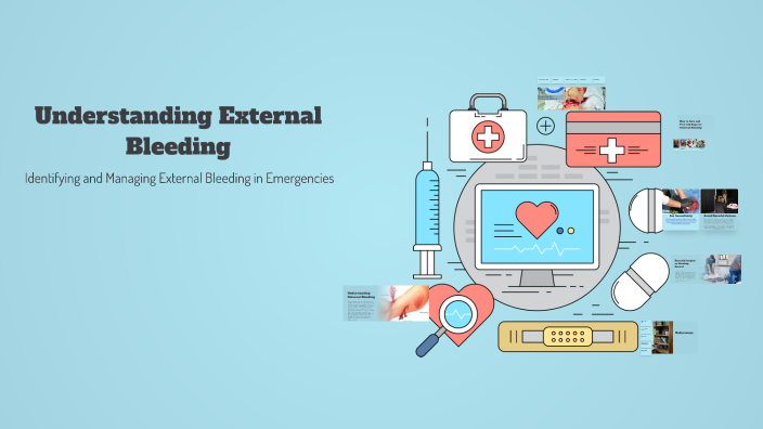 Understanding External Bleeding: Recognition and Response by Rael ...