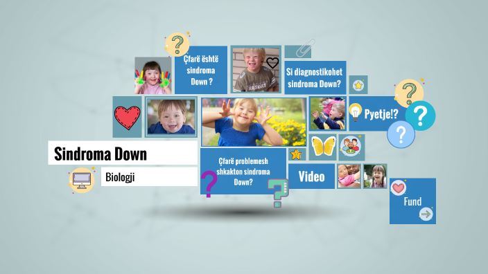 Sindroma Down by Biologji Teknologji on Prezi