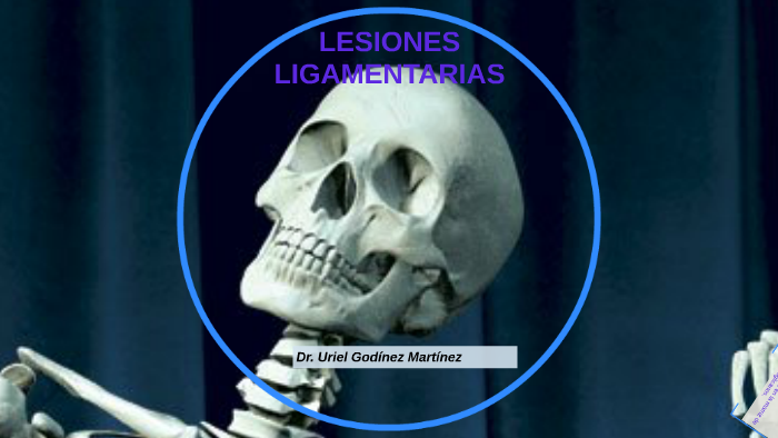 LESIONES LIGAMENTARIAS by uriel godinez martinez on Prezi